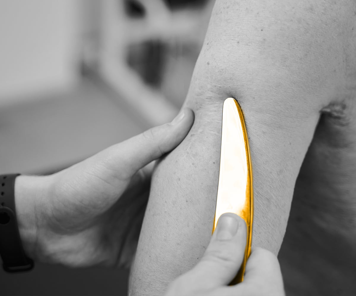 Graston Technique in Utah | Break Up Scar Tissue & Relieve Pain